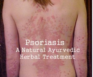 Psoriasis - A Natural Ayurvedic Herbal Treatment - Pioneerthinking.com